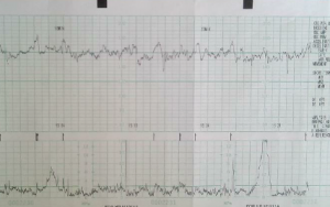 Suivi de grossesse - Stéphanie Weiss Sage-femme